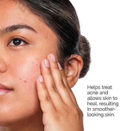 The Ordinary - The Acne Set – The Vault Pk